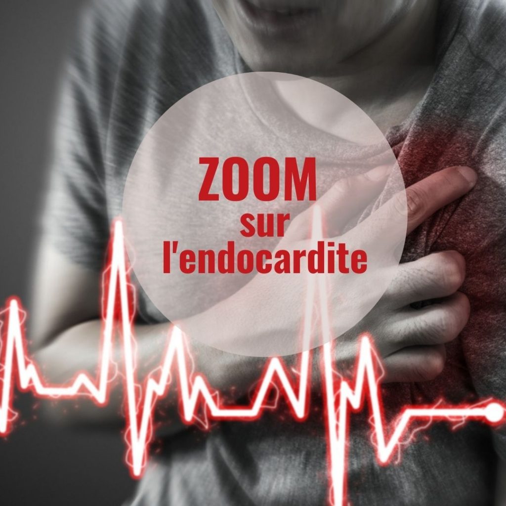 Zoom sur l'endocardite